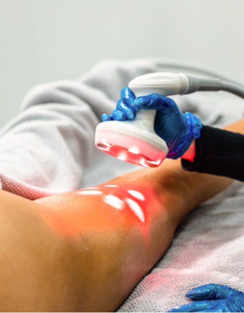 RF Fat Melting | Radio Frequency | Elite Body Contouring