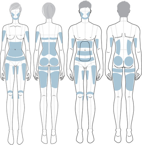 RF Fat Melting | Radio Frequency | Elite Body Contouring